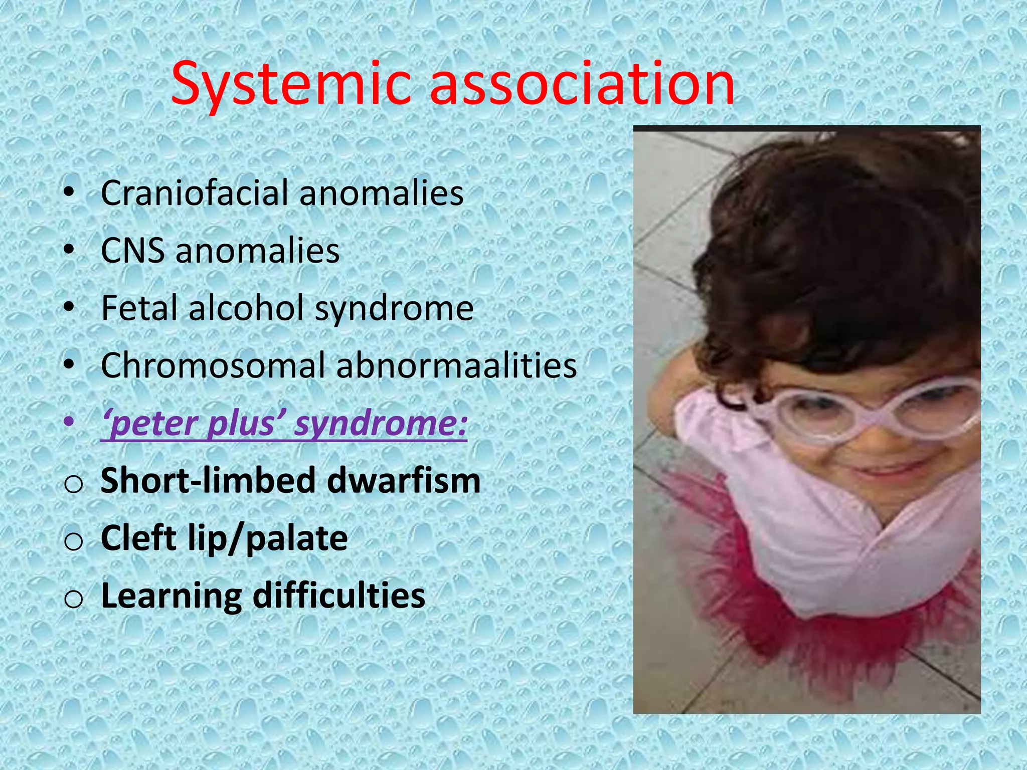 Congenital glaucoma part2; developmental glaucoma | PPTX