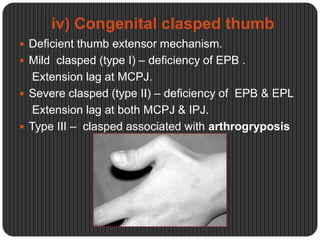 Congenital hand anomalies | PPTX