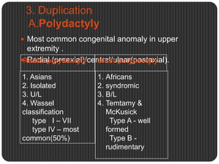 Congenital hand anomalies | PPTX