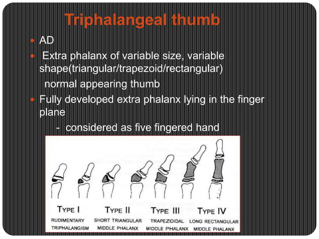 Congenital hand anomalies | PPTX