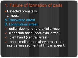 Congenital hand anomalies | PPTX