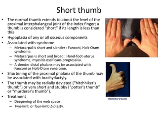 Congenital hand anomalies | PPTX