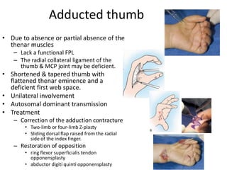 Congenital hand anomalies | PPTX