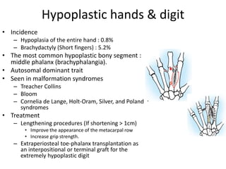 Congenital hand anomalies | PPT