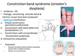 Congenital hand anomalies | PPT