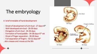congenital hand anomalies sa3d.pptx | Infertility | Reproductive Health