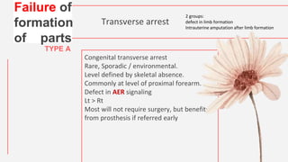 congenital hand anomalies sa3d.pptx | Infertility | Reproductive Health