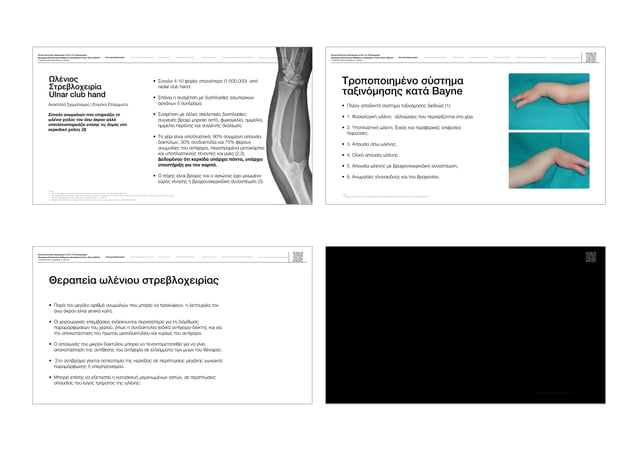 Congenital Hand Deformities Teaching.pdf