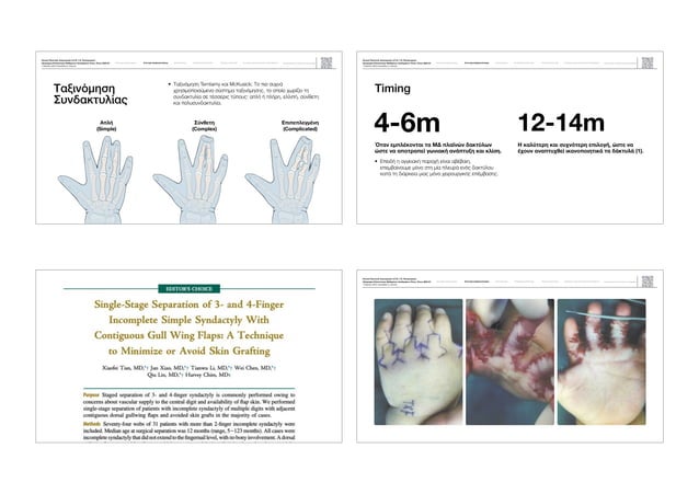 Congenital Hand Deformities Teaching.pdf