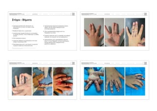 Congenital Hand Deformities Teaching.pdf
