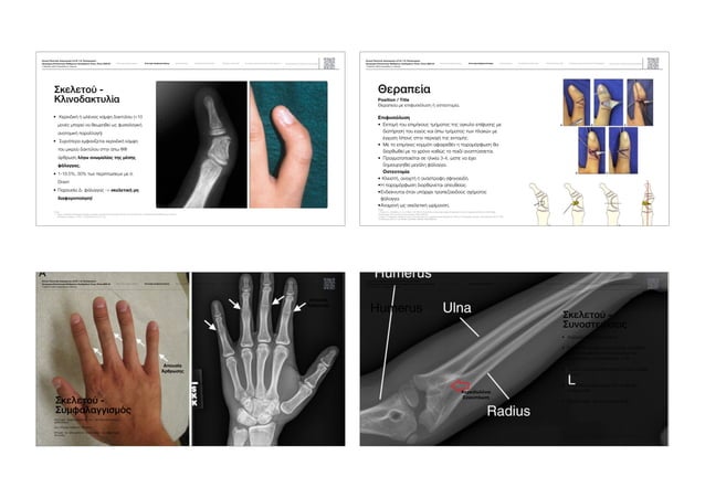 Congenital Hand Deformities Teaching.pdf