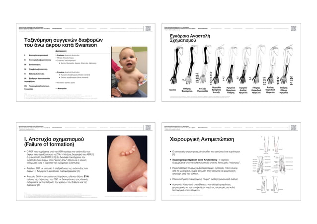 Congenital Hand Deformities Teaching.pdf