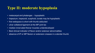 Thumb hypoplasia - congenital hand III | PPTX