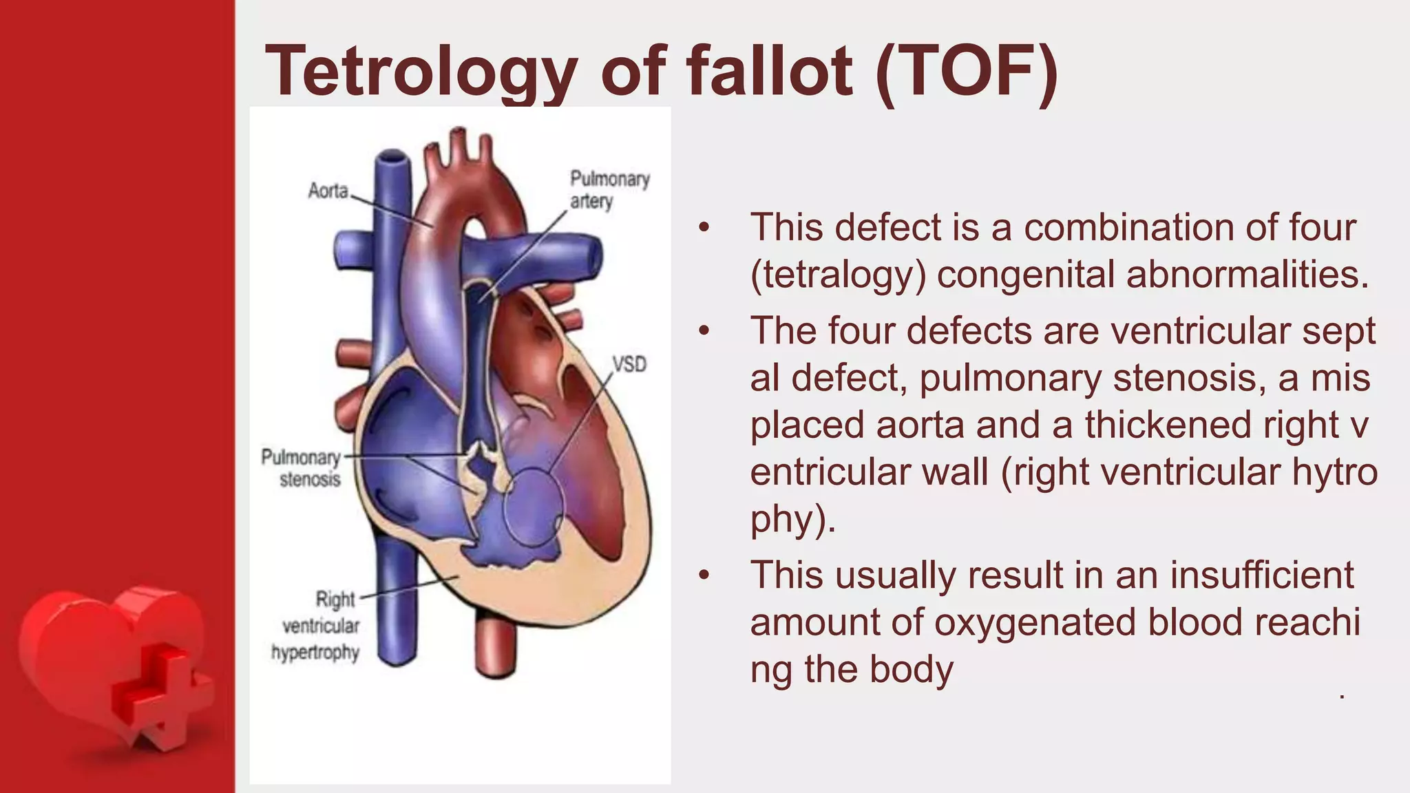 Congenital heart diseases | PPTX