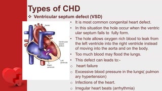 Congenital heart diseases | PPTX