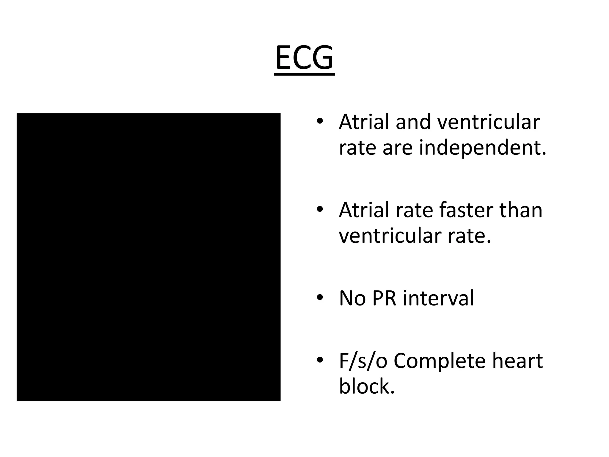 Congenital heart block | PPTX