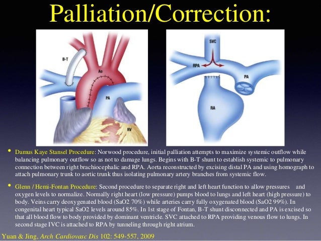 Congenital Heart Defects