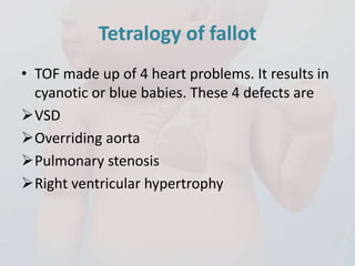 Congenital heart defects | PPTX