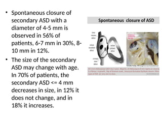 Congenital heart defects defect of the heart related to the congenital .ppt