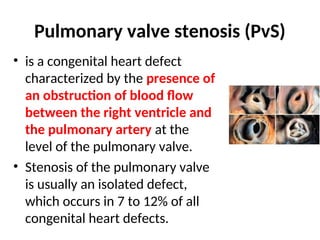 Congenital heart defects defect of the heart related to the congenital .ppt
