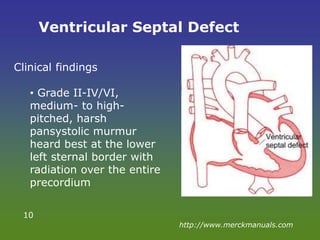 Congenital heart disease | PPTX