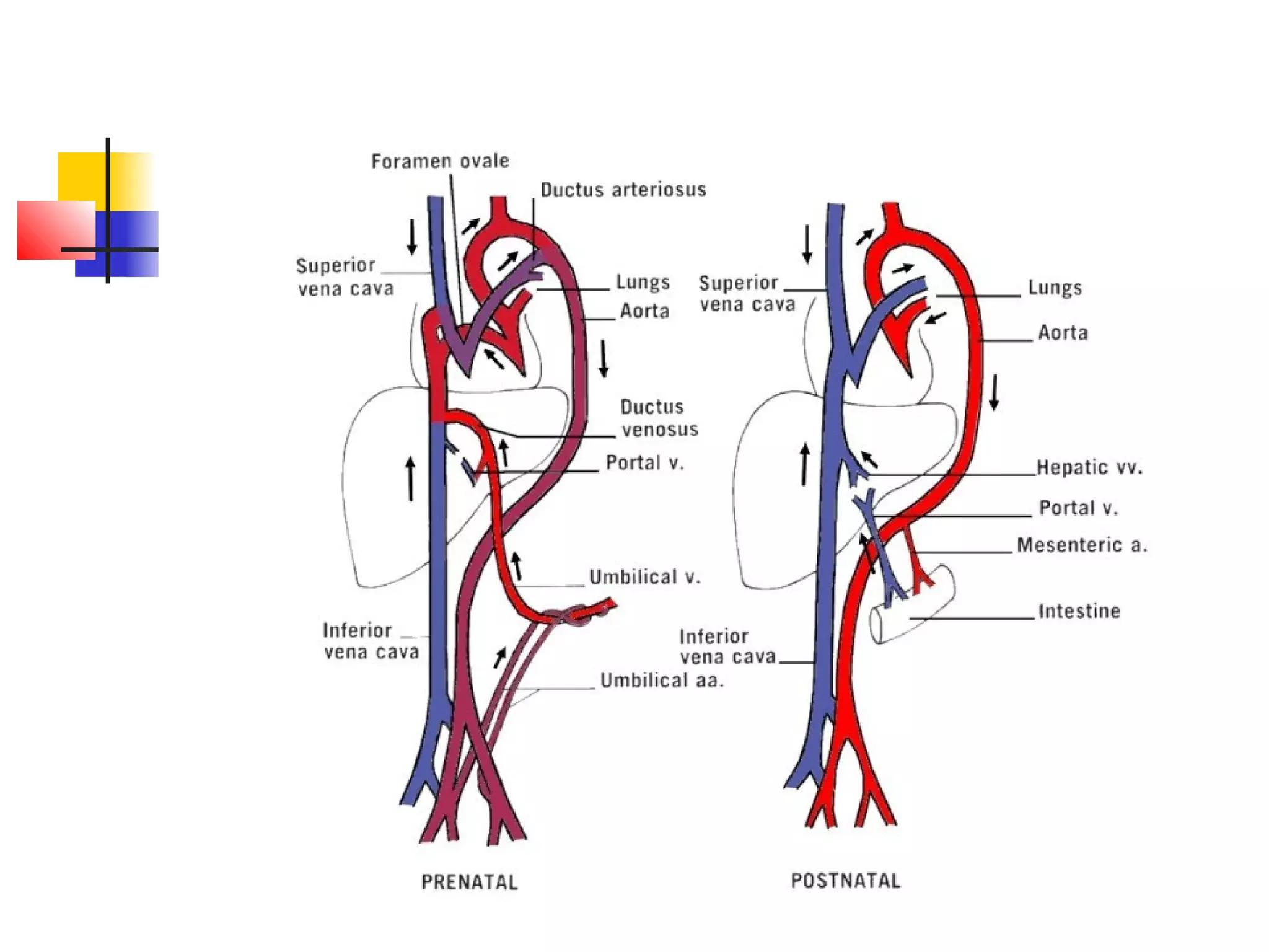 Congenital heart disease | PPT