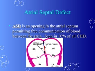 Congenital heart disease | PPT