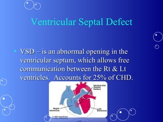 Congenital heart disease | PPT