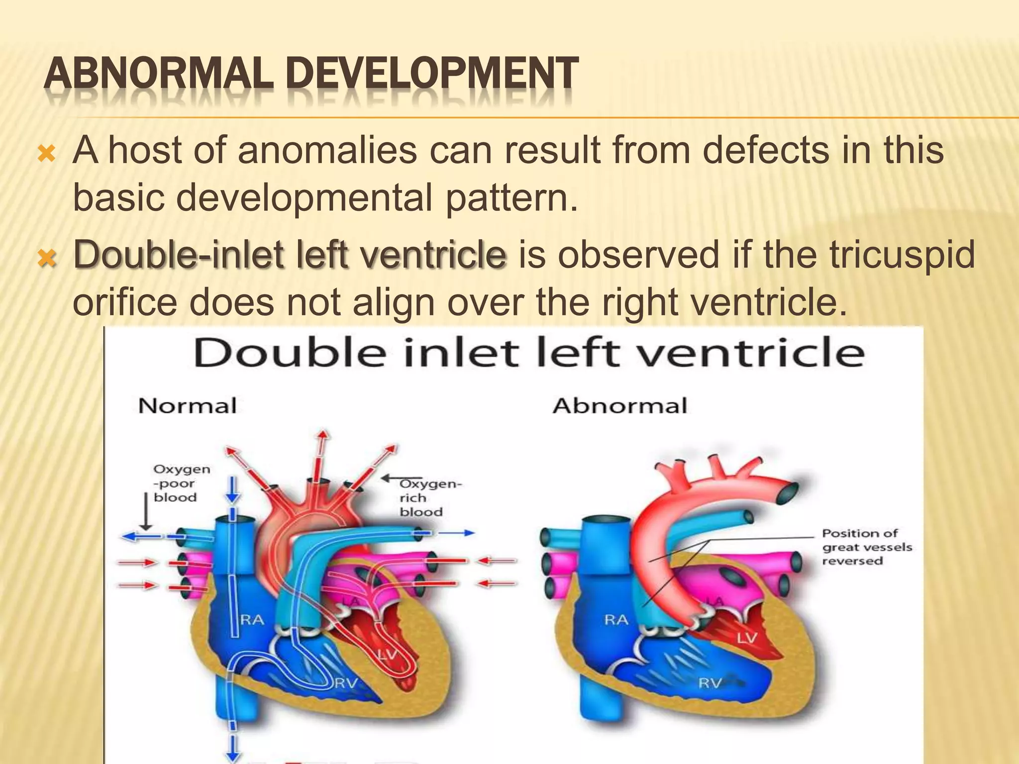 Congenital heart disease | PPT