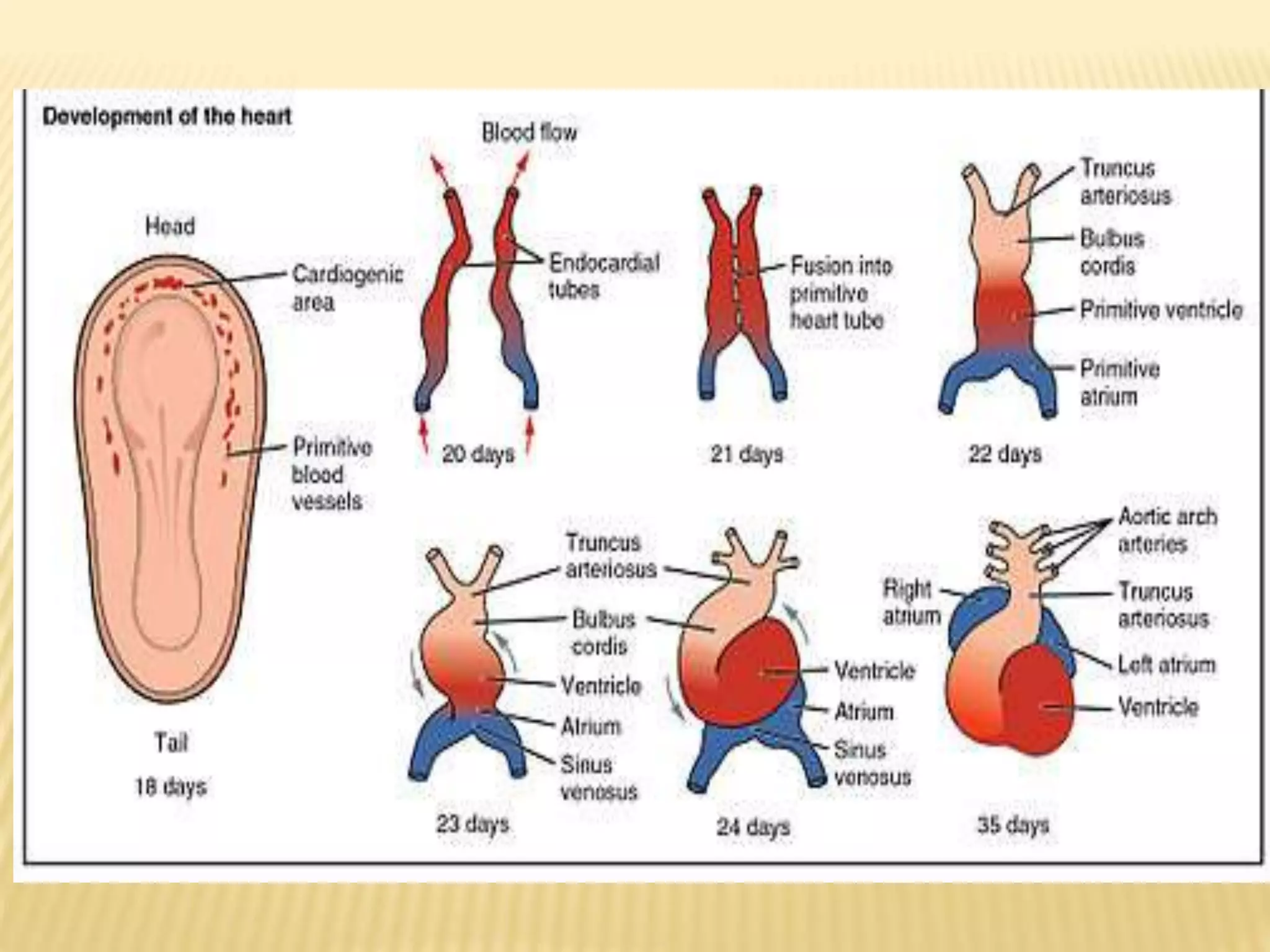 Congenital heart disease | PPT