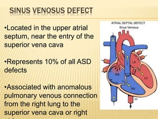 Congenital heart disease | PPTX