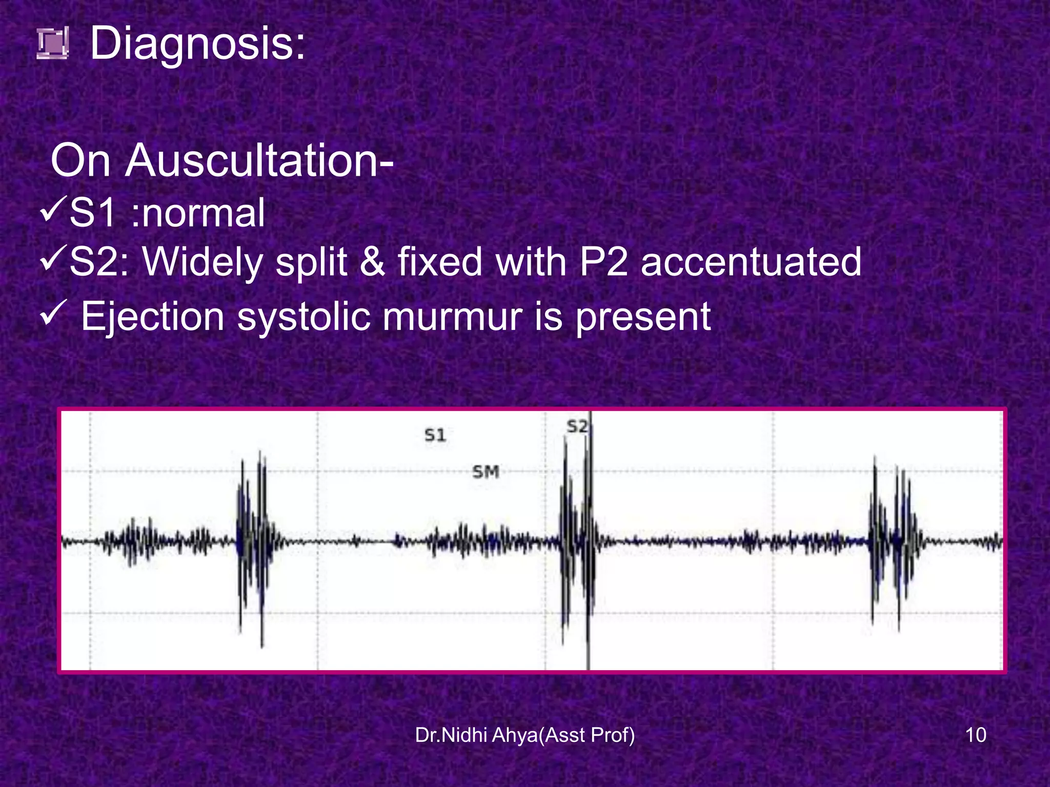 Congenital heart disease | PPTX