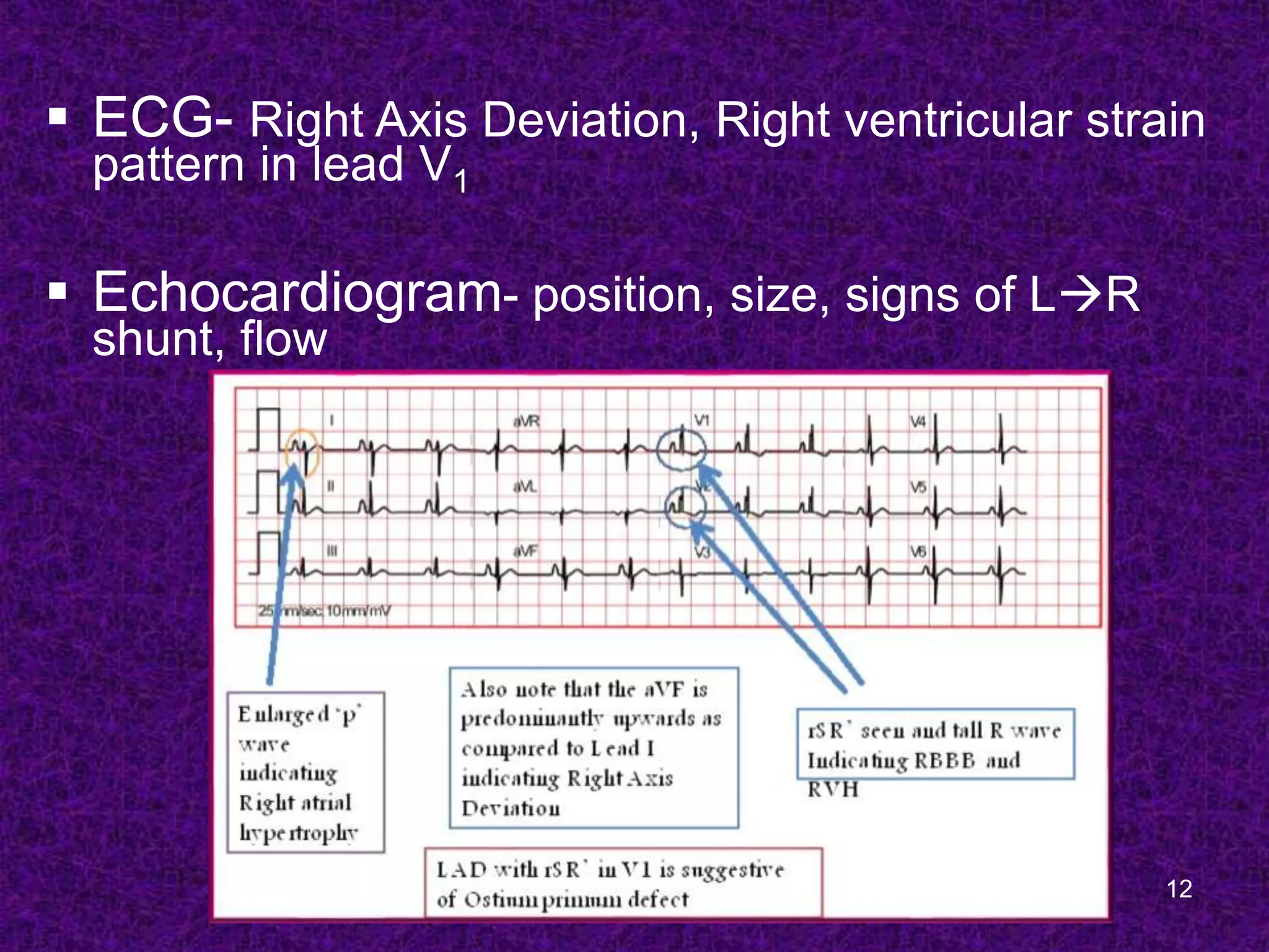 Congenital heart disease | PPTX