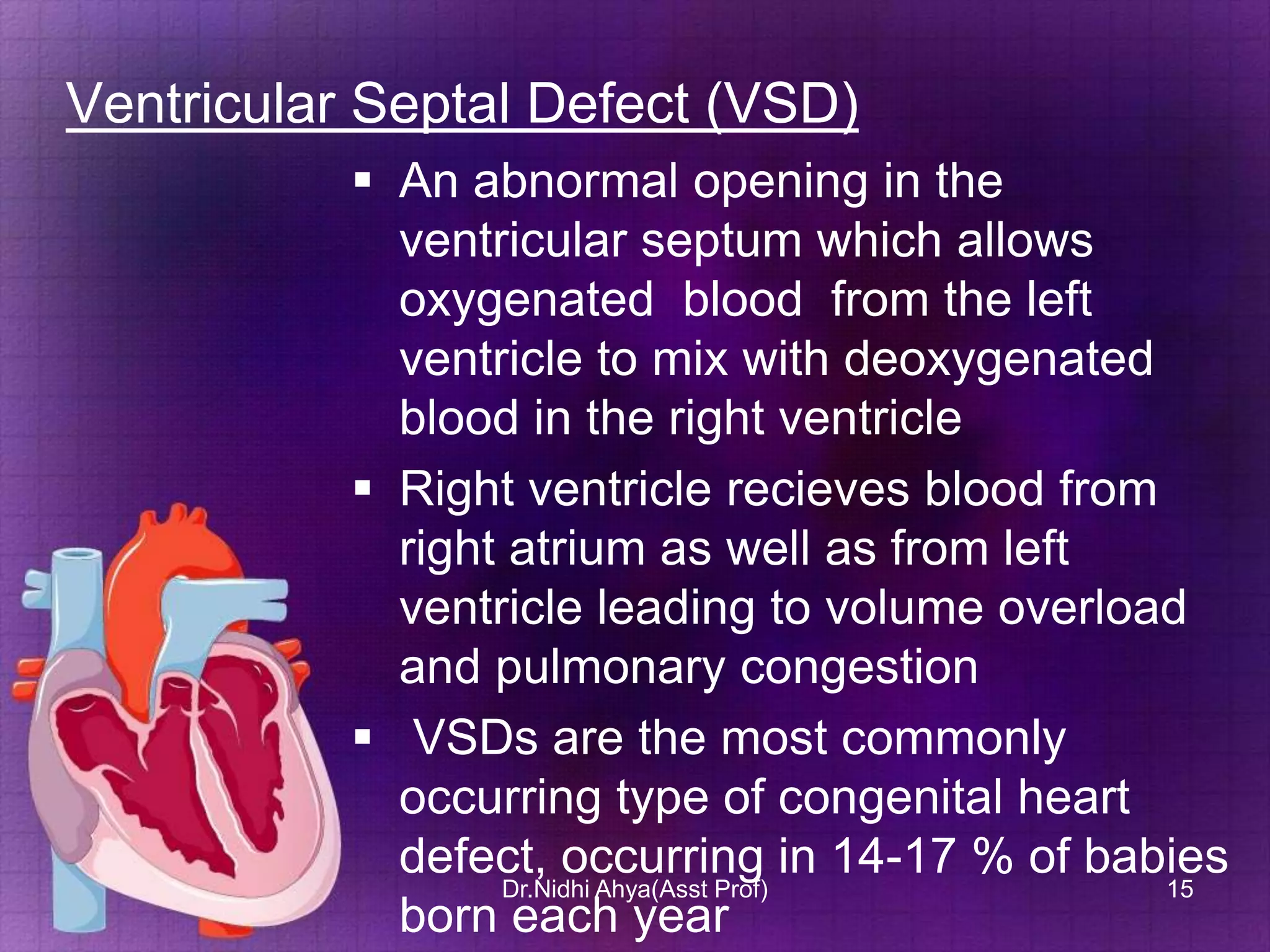 Congenital heart disease | PPTX