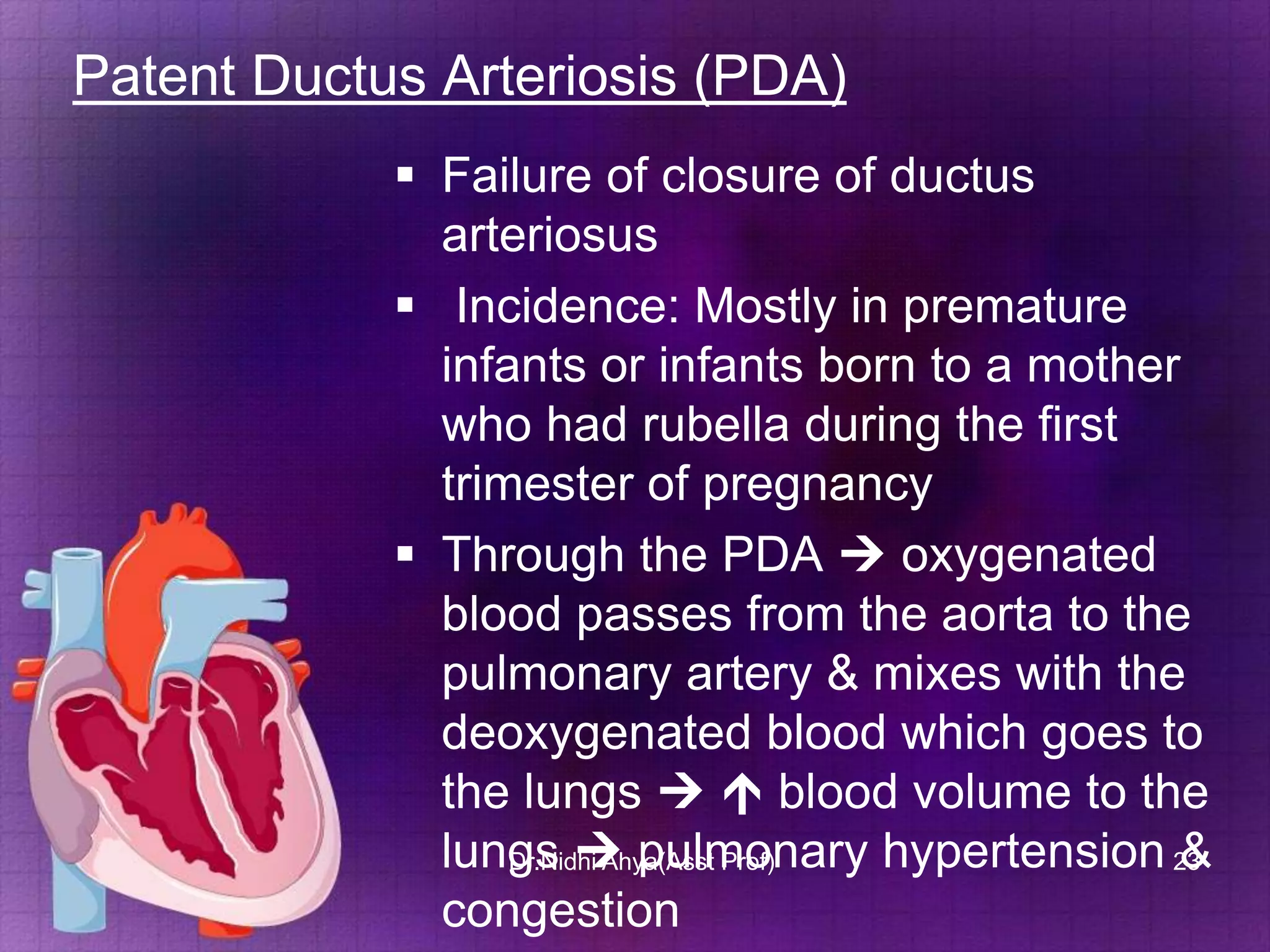 Congenital heart disease | PPTX