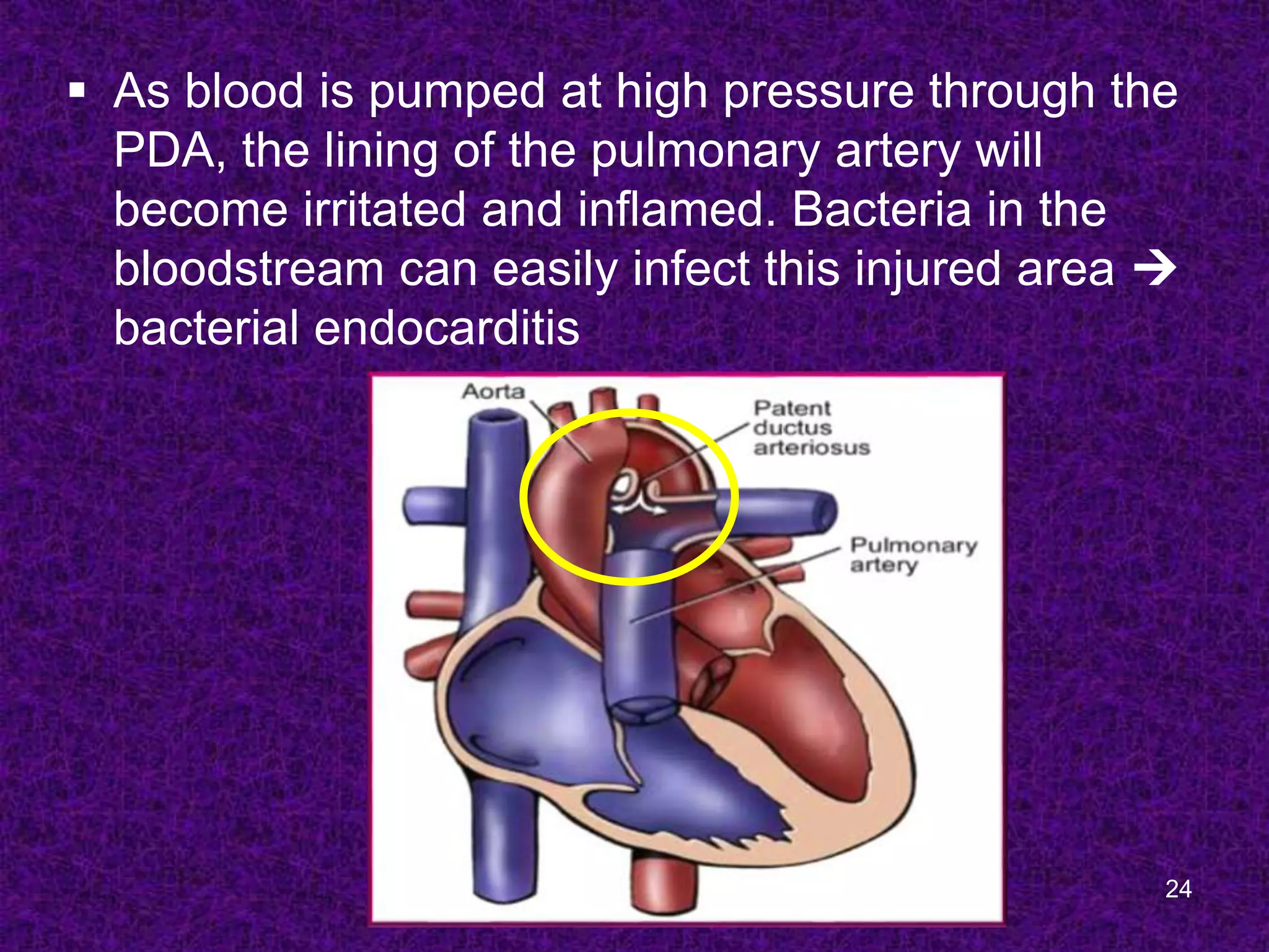 Congenital heart disease | PPTX