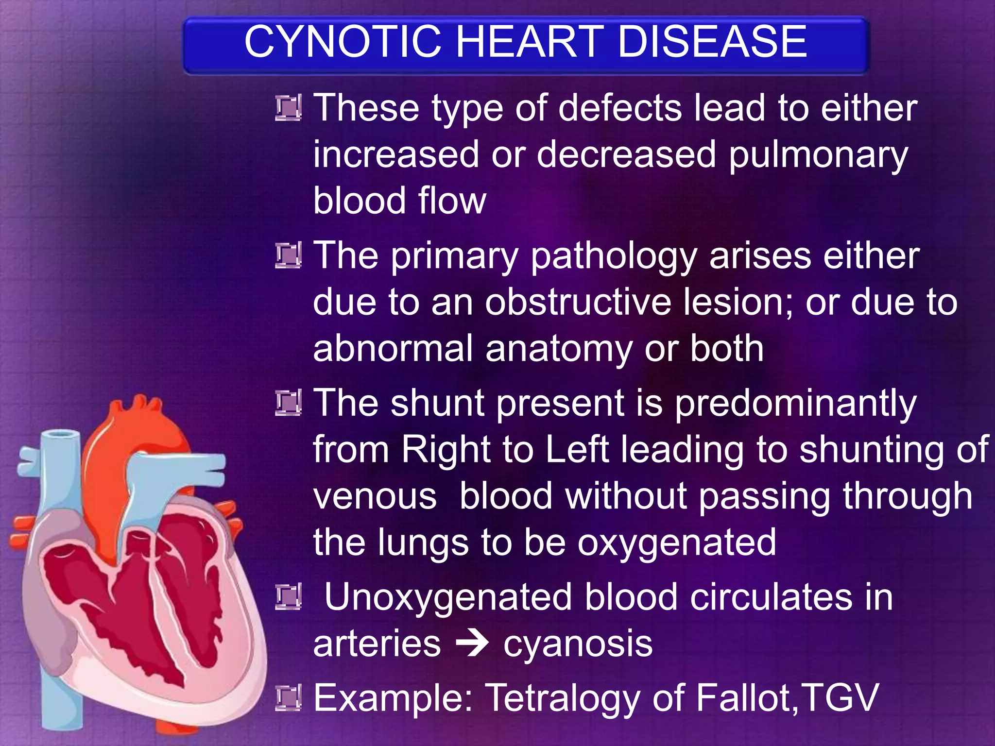Congenital heart disease | PPTX