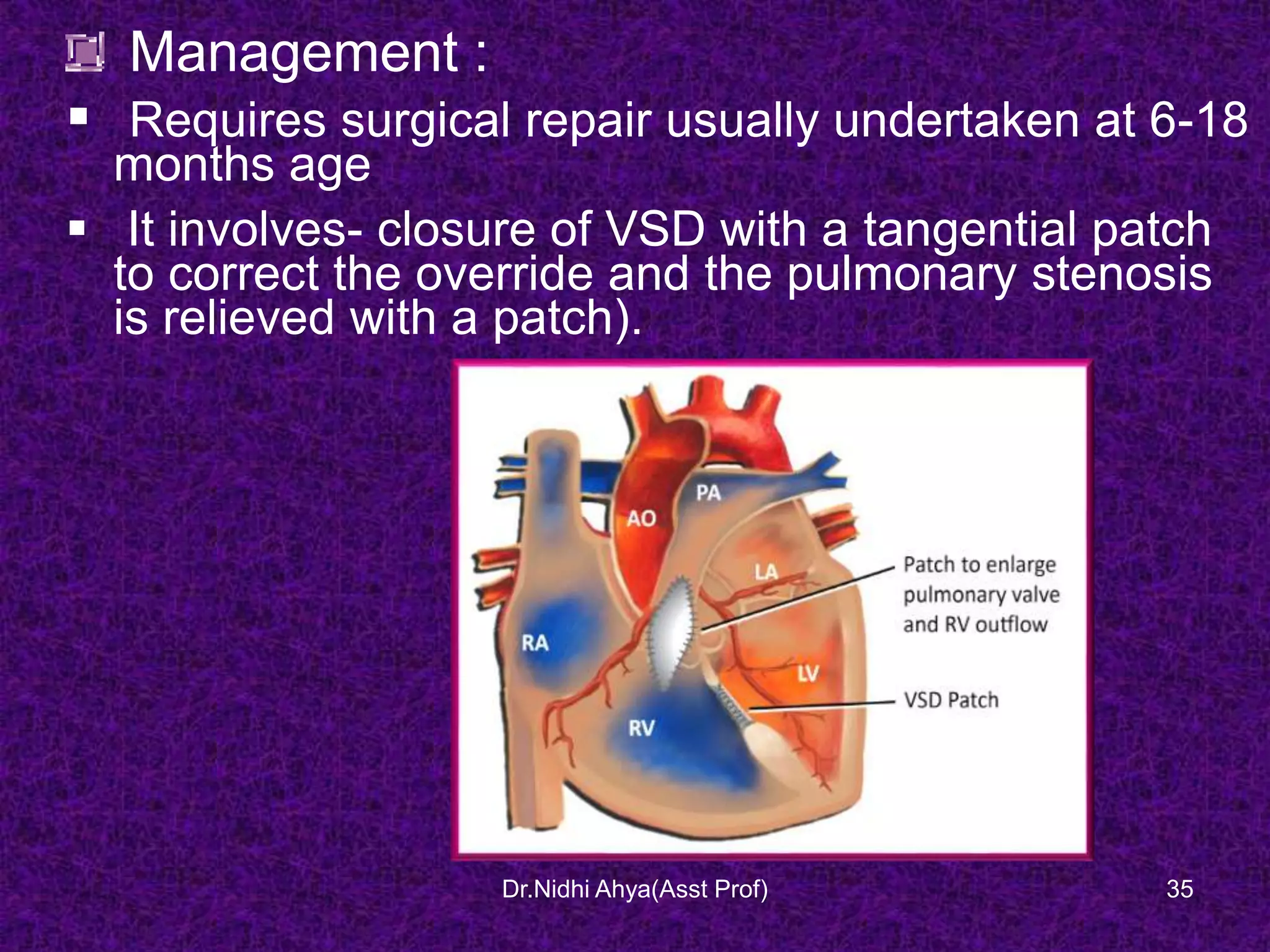 Congenital heart disease | PPTX