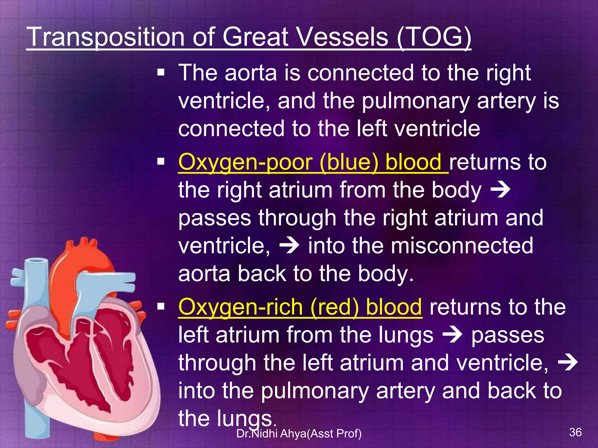 Congenital heart disease | PPTX