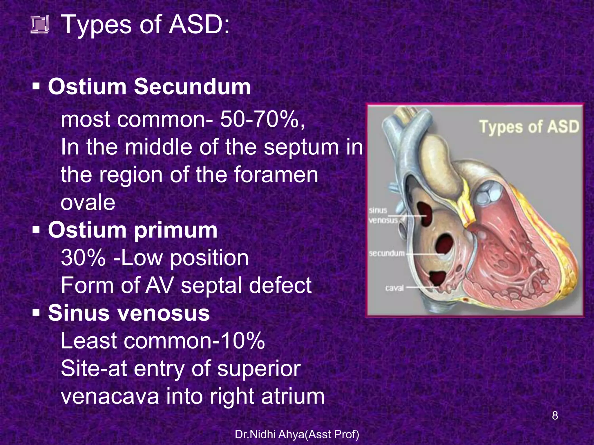 Congenital heart disease | PPTX