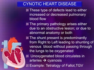 Congenital heart disease | PPTX