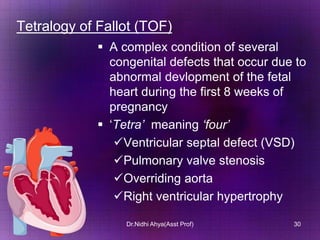 Congenital heart disease | PPTX