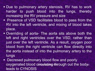 Congenital heart disease | PPTX