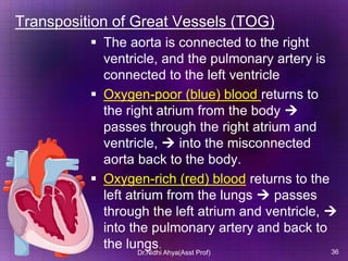 Congenital heart disease | PPTX