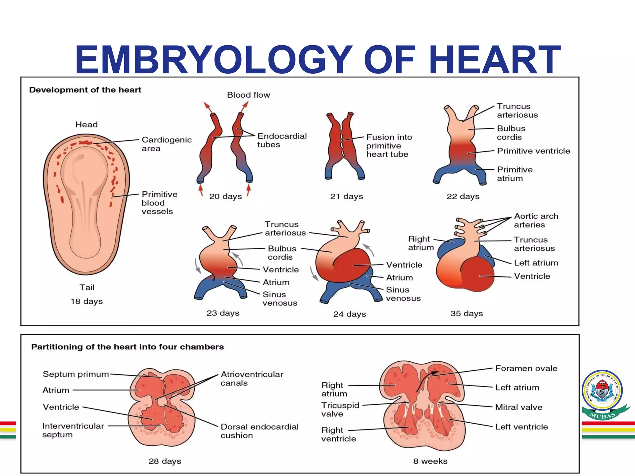 Congenital heart disease | PDF