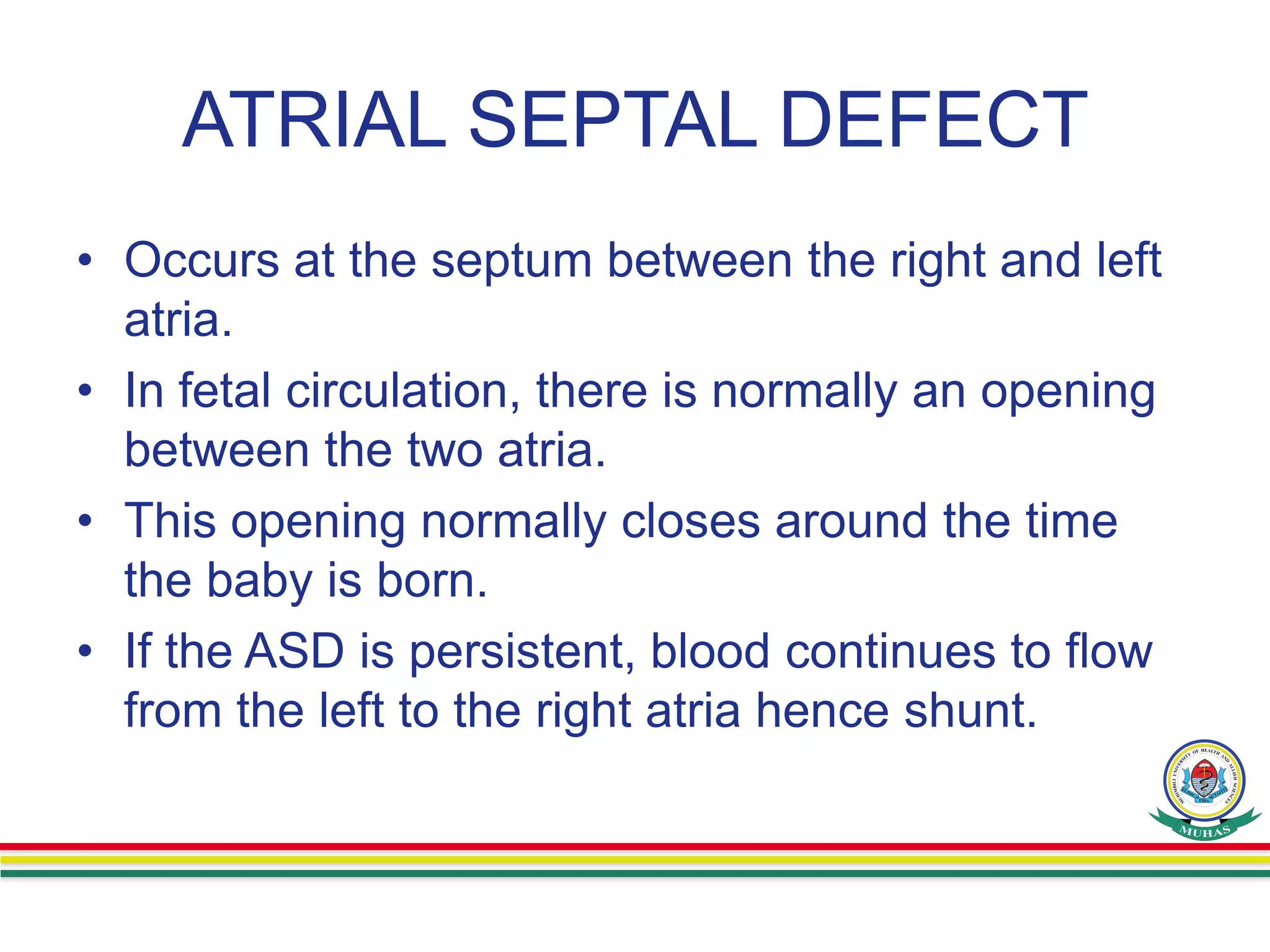 Congenital heart disease | PDF