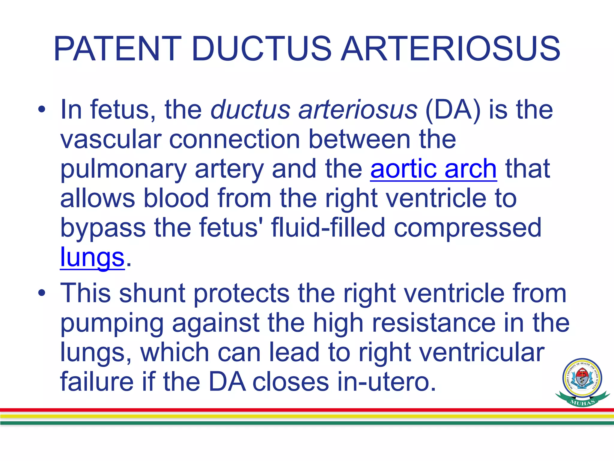 Congenital heart disease | PDF