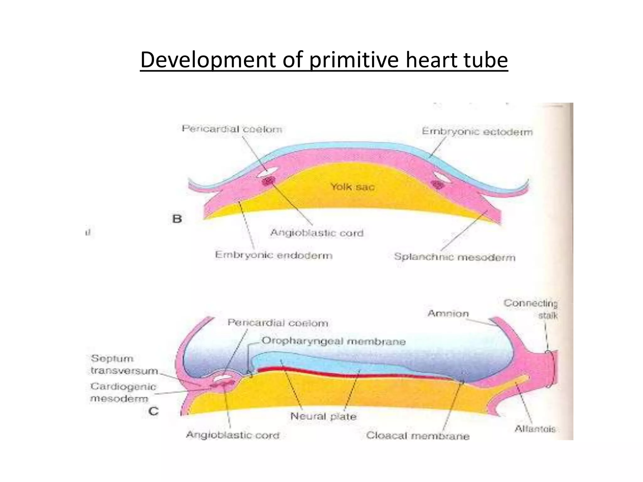 Congenital heart disease | PPT