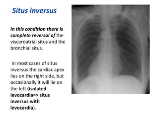 Congenital heart disease | PPT