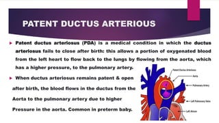 Congenital heart disease | PPTX